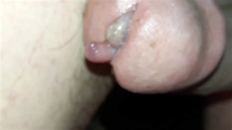 Worms In Cock Video 2