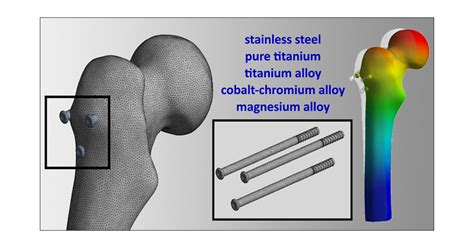 performance assessment of biocompatible metals used in the treatment of femoral neck fractures