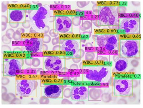 Github Sk Blood Cell Enumeration Blood Cell Detection And