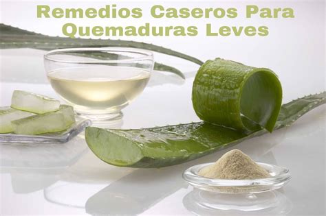 15 remedios caseros para quemaduras leves La Guía de las Vitaminas
