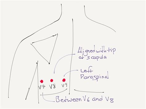 V V V Lead Placement Lineartdrawingstattoo