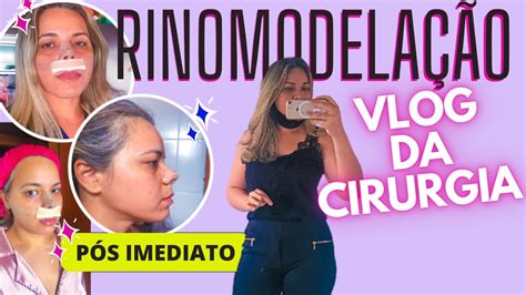 Fiz CIRURGIA DE RINOMODELAÇÃO RESULTADO DO PÓS IMEDIATO Diário da