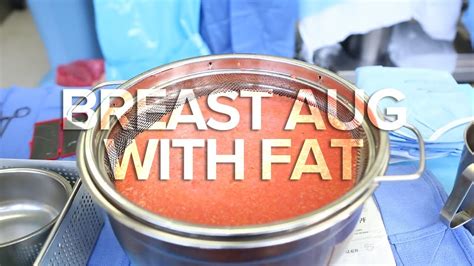 BEFORE AND AFTER FAT TRANSFER TO BREASTS YouTube