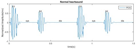 applied sciences free full text research on segmentation and classification of heart sound