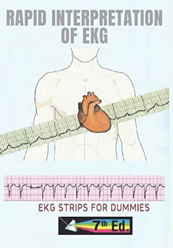 Rapid Interpretation Of EKG 7th Edition EKG Strips For Dummies By Dr