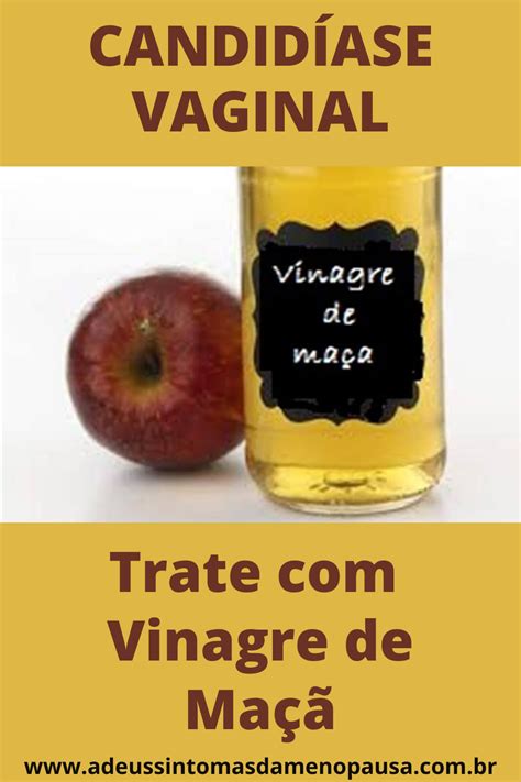 Remédio Caseiro Para Coceira Vaginal