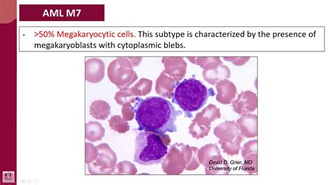 Hematology U L Fab Classification Of Aml Subtypes Youtube