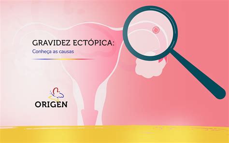 Oq E Gravidez Ectópica