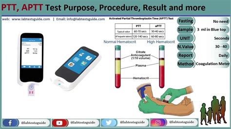 Activated Partial Thromboplastin Time Aptt Lab Tests Guide