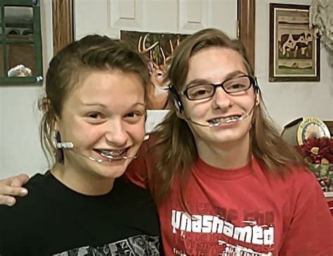 Pin By Larry Greenstein On Headgear Girls Orthodontics Braces Teeth Braces Braces Girls