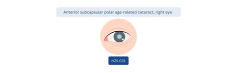 Optimizing Care With Z Pre Op Clearance In Healthcare