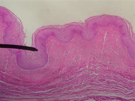 File Vagina Mucosa Wikimedia Commons