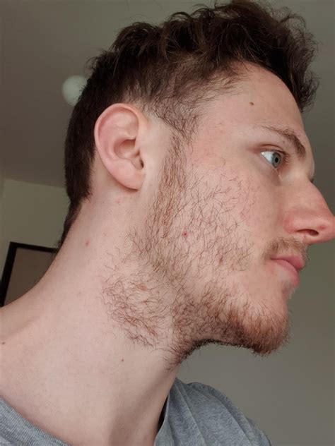 Ways To Grow Facial Hair Xxx Porn