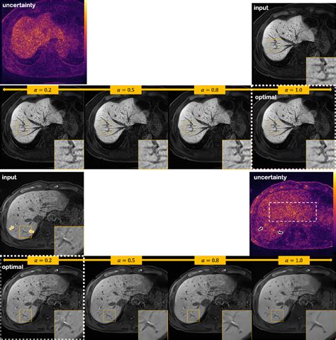 mr image denoising and super resolution using regularized reverse diffusion paper and code