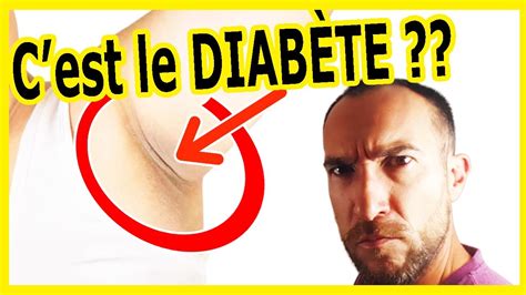 SYMPTÔMES DU DIABÈTE 7 Signes Qui Doivent VOUS Alerter YouTube