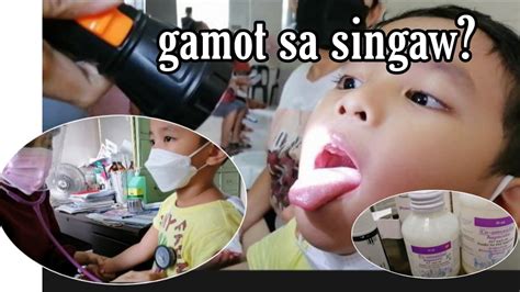 GAMOT SA SINGAW NI BABY RECOMMENDED BY PEDIA DOCTOR YouTube