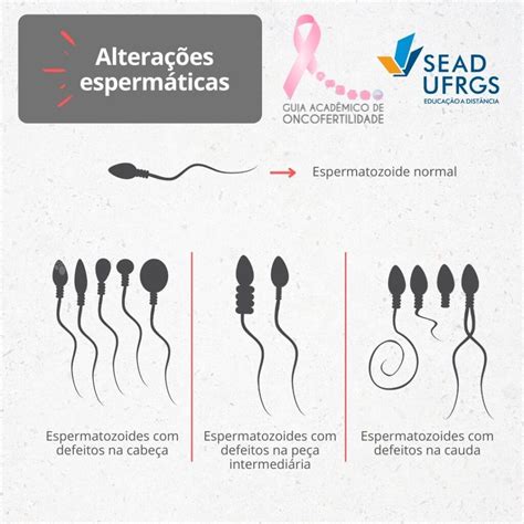 Fertilidade masculina GUIA ACADÊMICO DE ONCOFERTILIDADE
