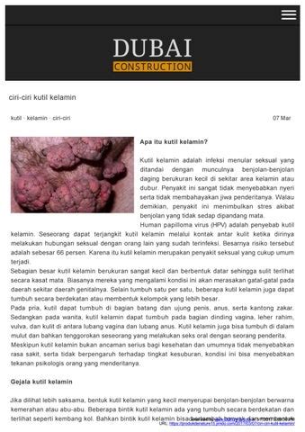 Cara Menghilangkan Kutil Secara Alami Tanpa Bekas By Quri Kovian Issuu