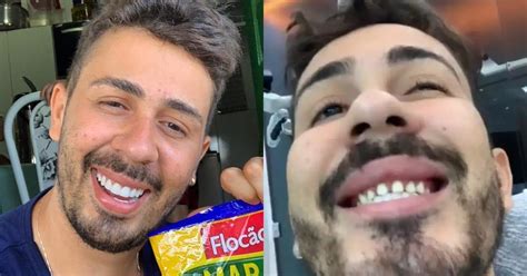 Carlinhos Maia Mostra Sorriso Sem Lentes Nos Dentes E Choca Seguidores