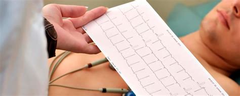 Electrocardiograma Qué es Cuánto cuesta CÂRDIUM