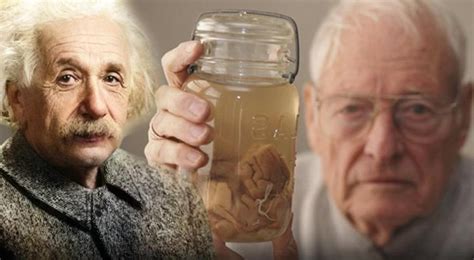 Einstein ın beynini çaldı 240 dilime böldü Böylesi ancak filmlerde