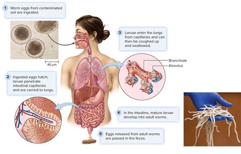 Ascariasis Life Cycles Aids Hiv Hiv