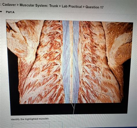 Solved Pal Cadaver Muscular System Trunk Lab Practical Chegg