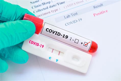 Teste de Covid saiba tudo sobre as opções disponíveis