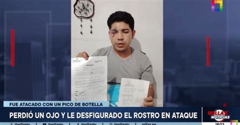 Ate Joven Pierde La Vista En Su Ojo Derecho Tras Ser Atacado Por