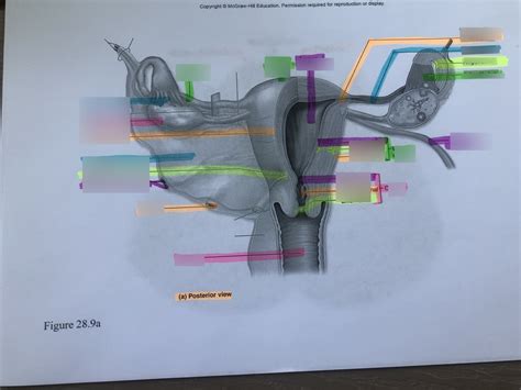 Lab Final Diagram Quizlet