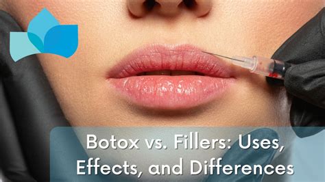 Botox Vs Fillers Uses Effects And Differences Edmonton Dermatology