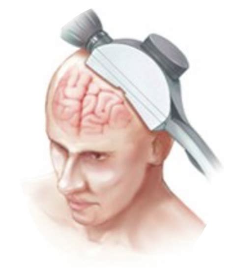 Neuromodulação não invasiva Especialidades