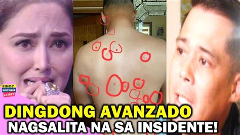 Dingdong Avanzado Idinitalye Ang Tila Bangungot Na Nangyari Sa Kanya