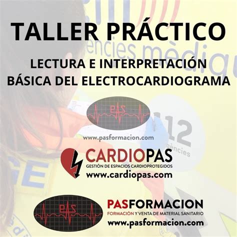Interpretación Del Electrocardiograma