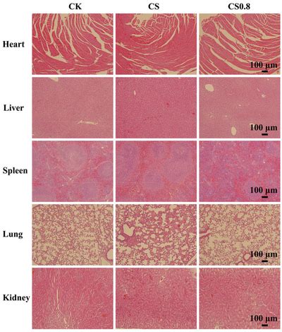 Photomicrographs Of The Major Organs Heart Liver Spleen Lung And