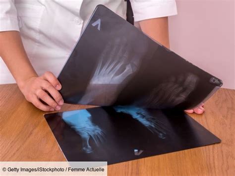 Que Faire De Ses Vieilles Radiographies Radiographie Faire Soi