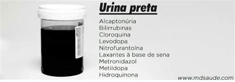 7 alterações na cor da urina e suas causas MD Saúde 2022