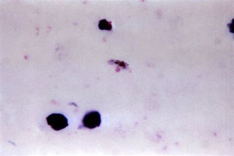 Free Picture Photomicrograph Blood Smear Plasmodium Falciparum
