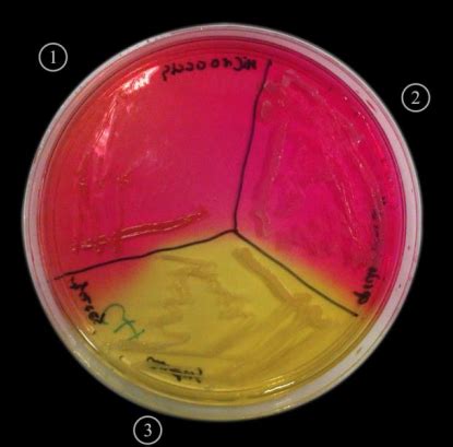 Lab Differential Selective Media A And P Test Bile Esculin