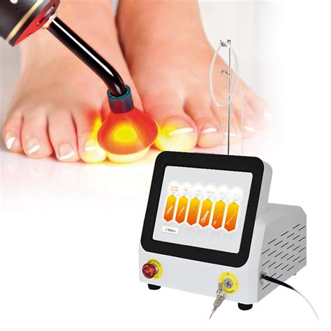 Clase Iv Nm Nm Podiatry Laser For Nail Fungus Onychomycosis