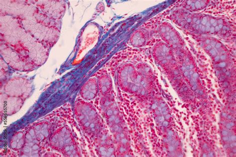 Tissue Of Small Intestine Duodenum Large Intestine Human And Stomach