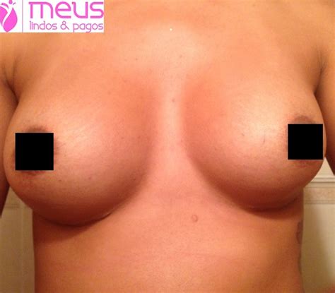 Meus Lindos E Pagos Arquivos Silicone Nos Seios Troca De Uma