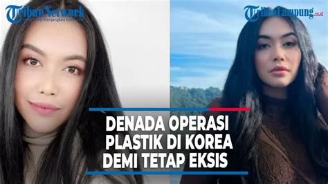 Denada Operasi Plastik Di Korea Demi Tetap Eksis Di Dunia Hiburan