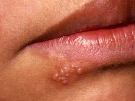 Hongos En Los Labios Secretos Propiedades 2021