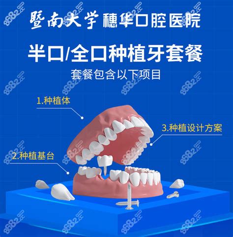 2022广州穗华口腔医院种植牙价格 揭晓穗华口腔种牙收费标准 种植牙 8682整形网