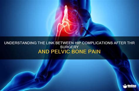 Understanding The Link Between Hip Complications After Thr Surgery And