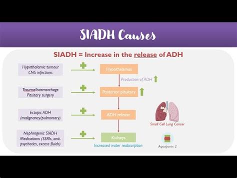 SIADH Explained Syndrome Of Inappropriate Antidiuretic Hormone YouTube