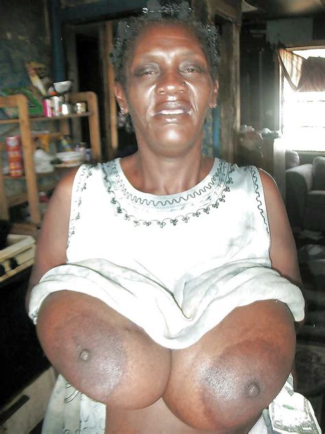 Huge Areola Pics Telegraph