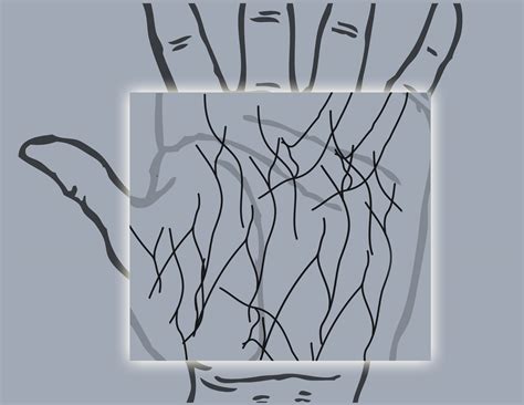 Iris Recognition Biometrics Vs Palm Vein Biometrics