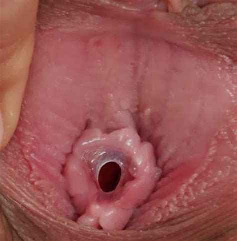 Perfect Pussies Hymen Telegraph